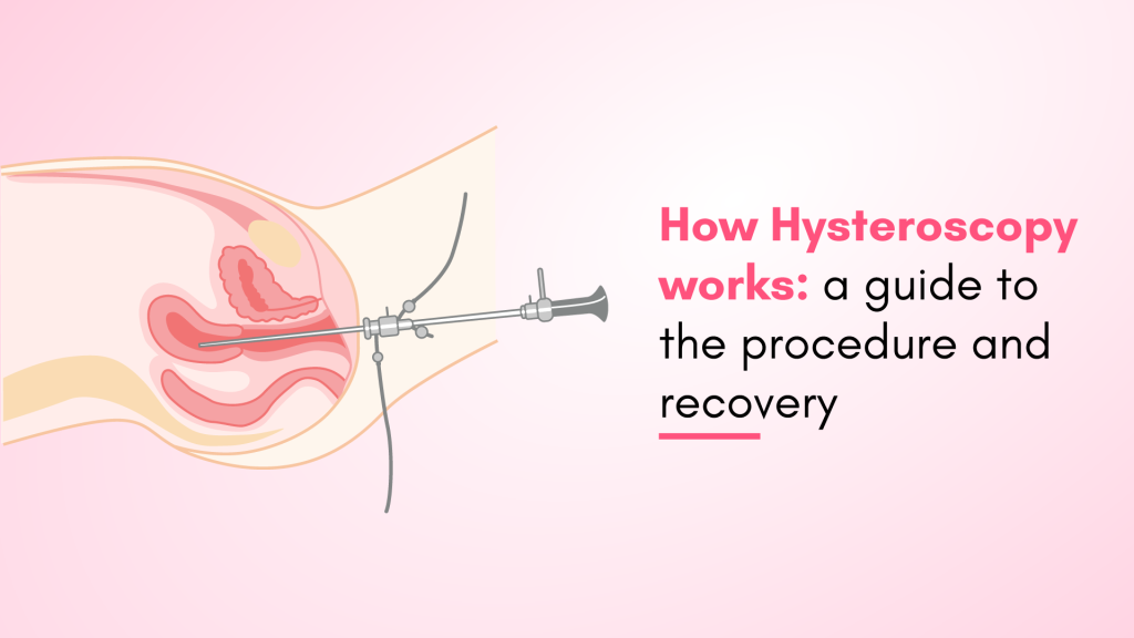 Hysteroscopy For Female Infertility Procedure And Recovery Guide hysteroscopy-for-female-infertility-procedure-and-recovery-guide