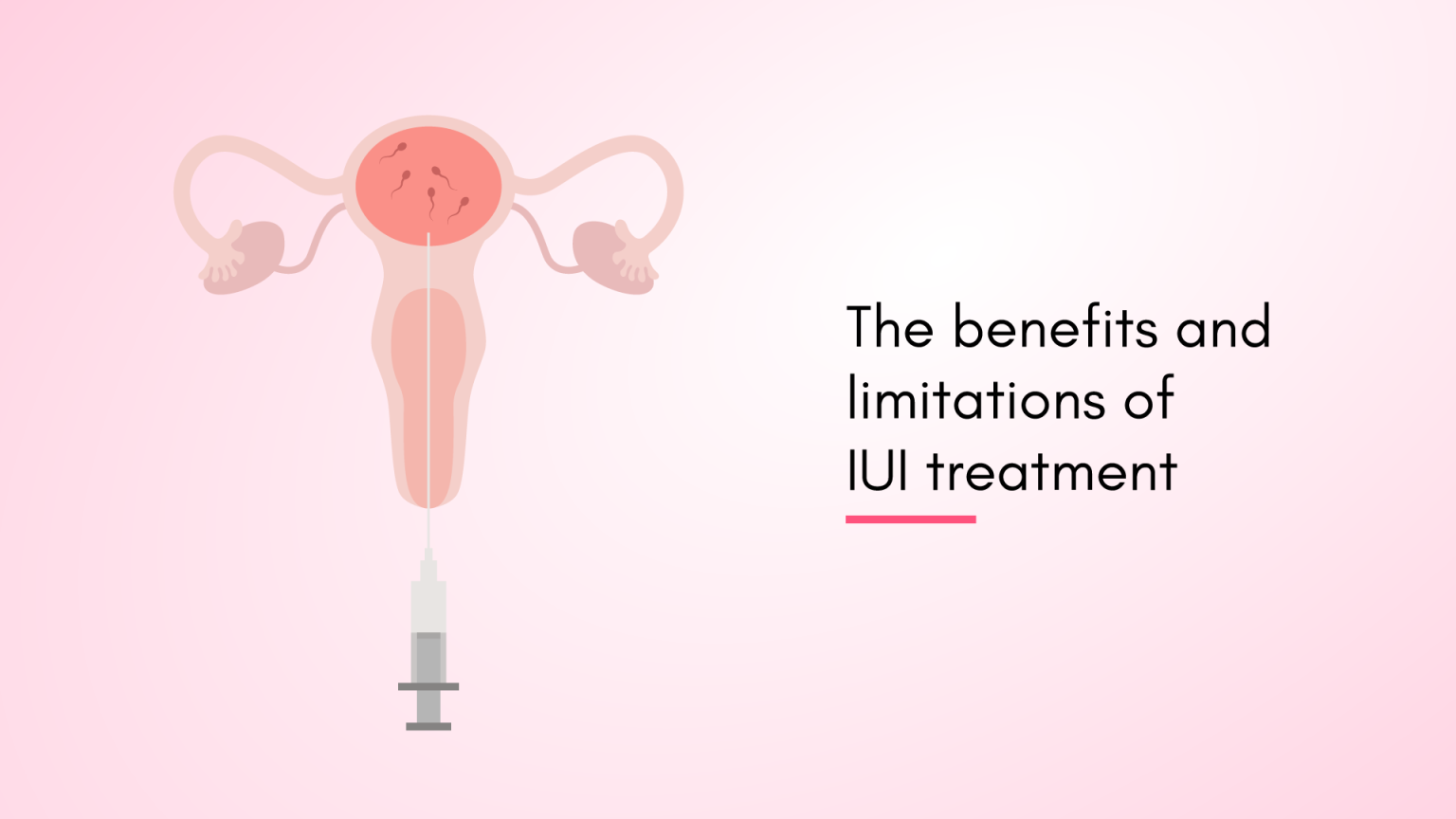 What are the Benefits and Limitations of IUI Treatment
