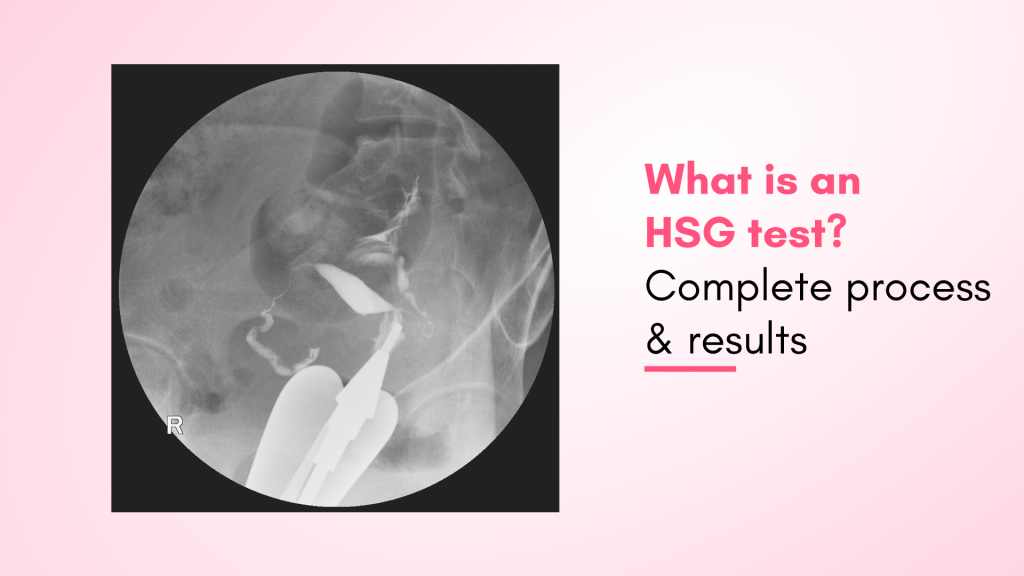 What is an HSG Test? A Guide to Process and Results